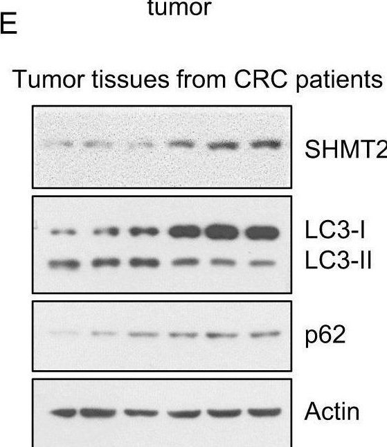 SHMT2 antibodies - Antibody search engine - CiteAb
