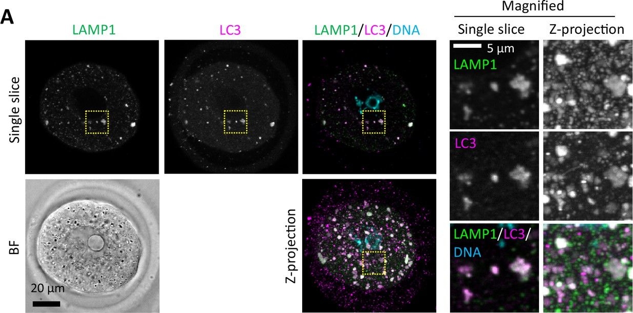 LAMP1 antibodies - Antibody search engine - CiteAb