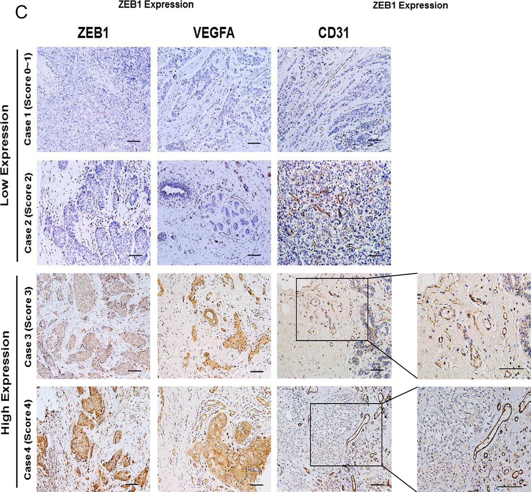 Zeb1 antibodies - Antibody search engine - CiteAb
