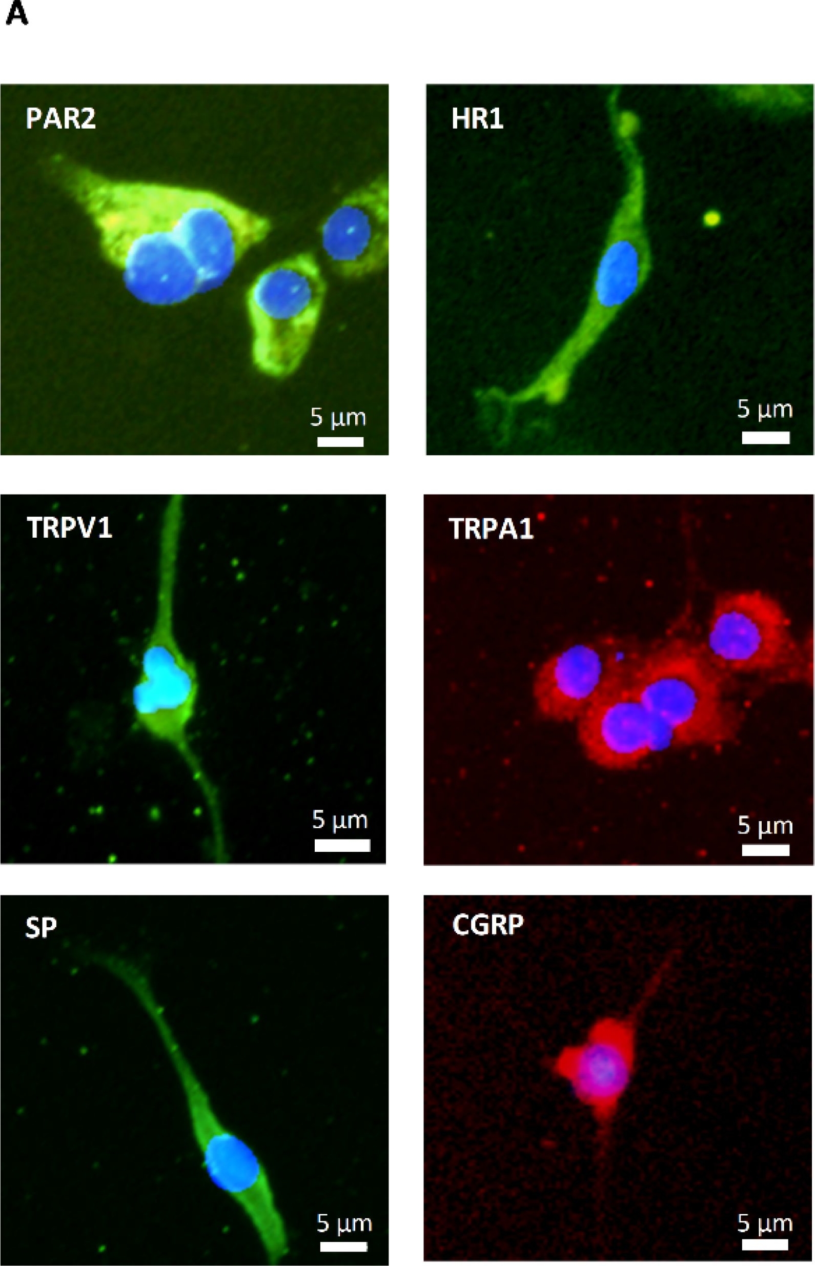 TRPA1 antibodies - Antibody search engine - CiteAb