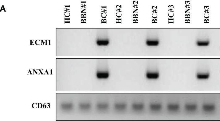 ECM1 antibodies - Antibody search engine - CiteAb
