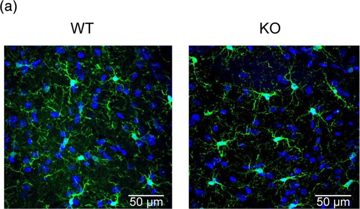 iba-1 antibodies - Antibody search engine - CiteAb