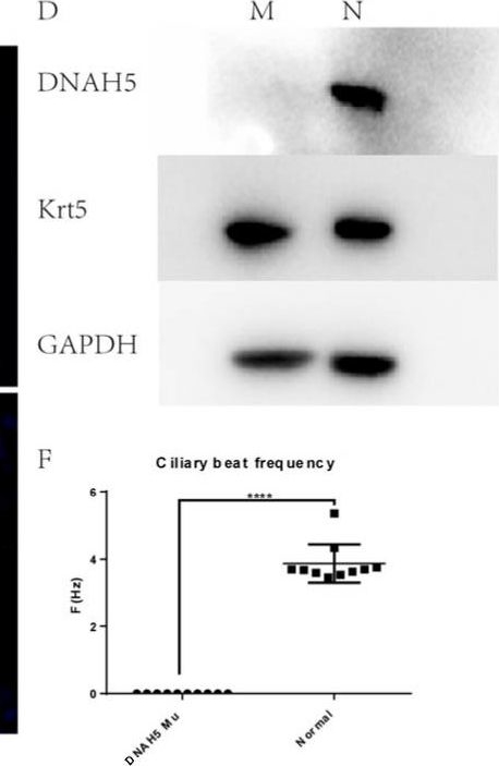 DNAH5 antibodies - Antibody search engine - CiteAb