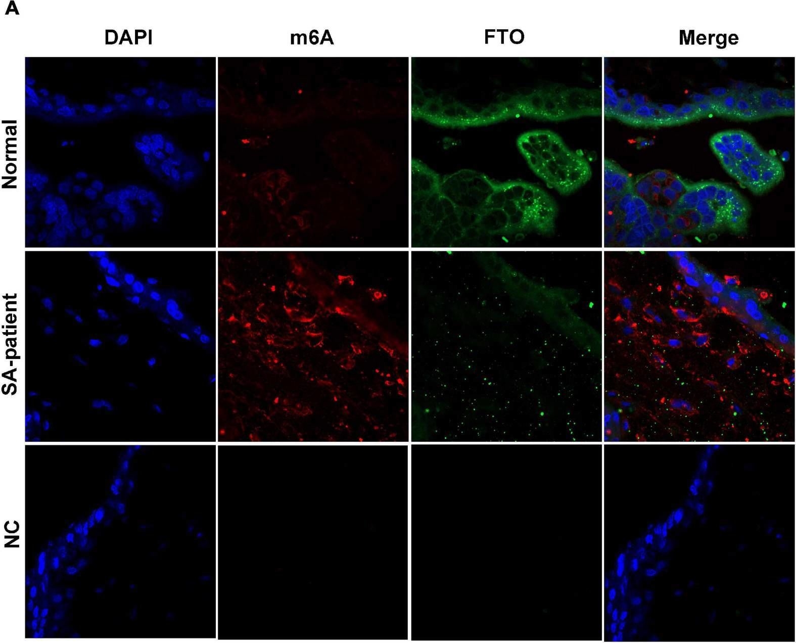 m6A antibodies - Antibody search engine - CiteAb