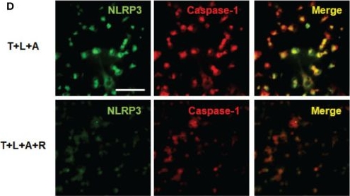 NLRP3 antibodies - Antibody search engine - CiteAb