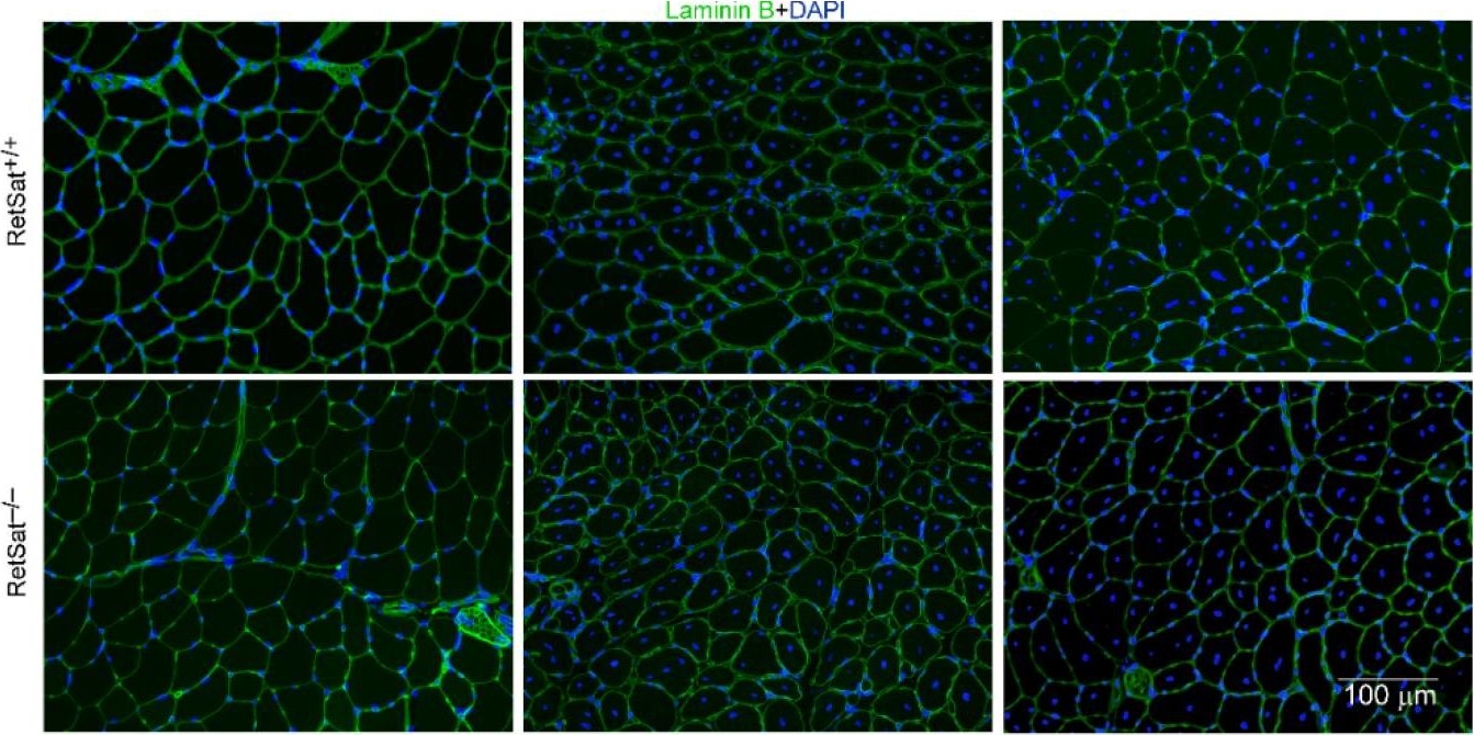 LAMA2 antibodies - Antibody search engine - CiteAb