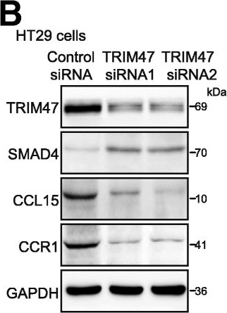 trim47 antibodies - Antibody search engine - CiteAb