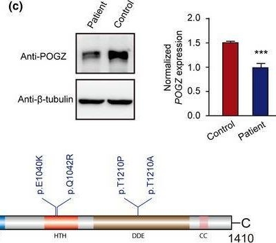 POGZ antibodies - Antibody search engine - CiteAb