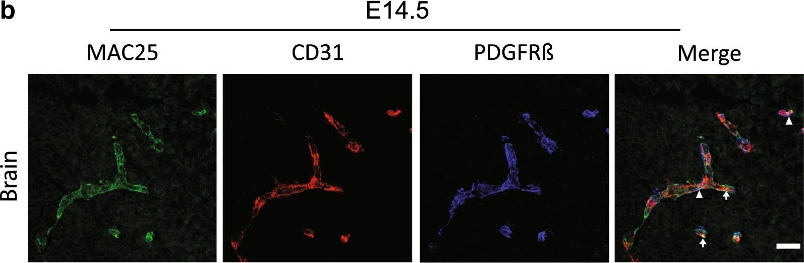 Pdgfrb antibodies - Antibody search engine - CiteAb