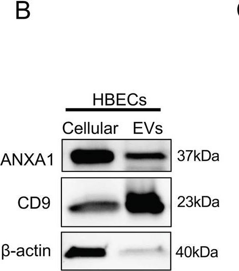 ANXA1 antibodies - Antibody search engine - CiteAb