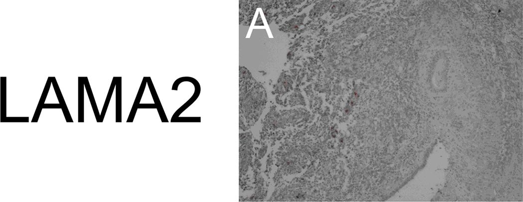 LAMA2 antibodies - Antibody search engine - CiteAb