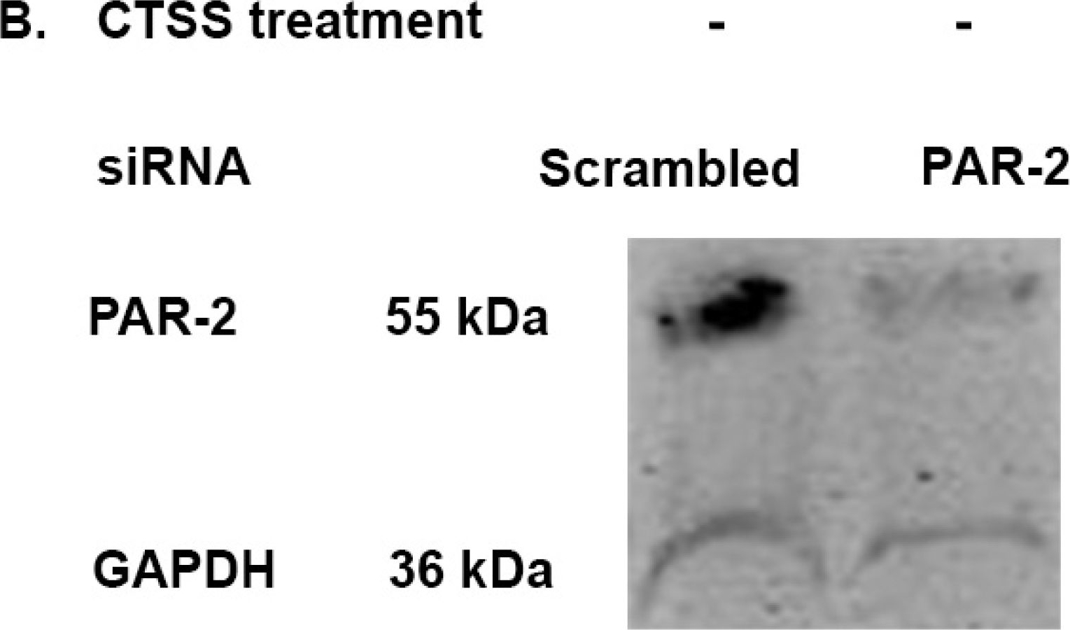 F2RL1 antibodies - Antibody search engine - CiteAb