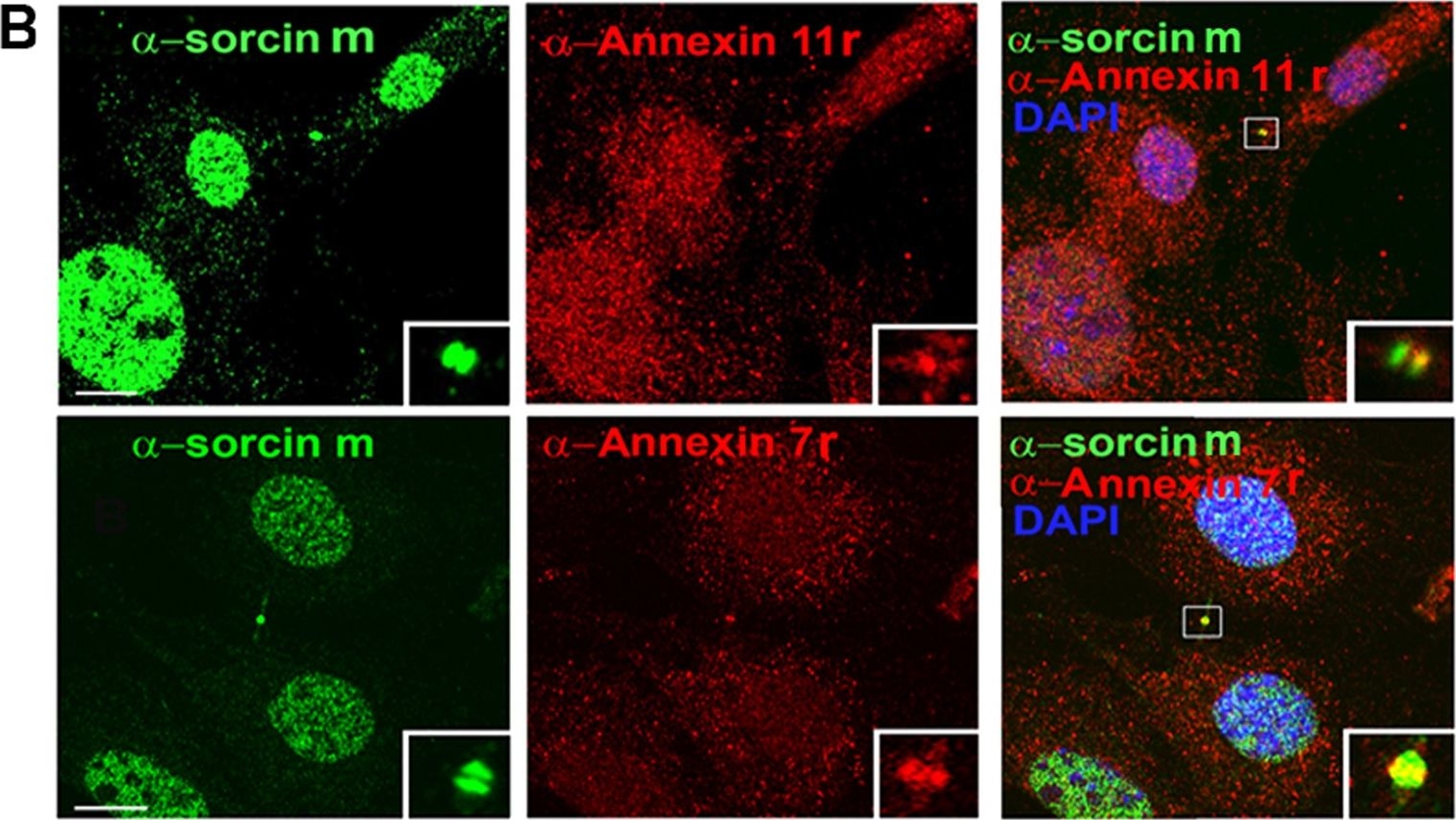 ANXA11 antibodies - Antibody search engine - CiteAb