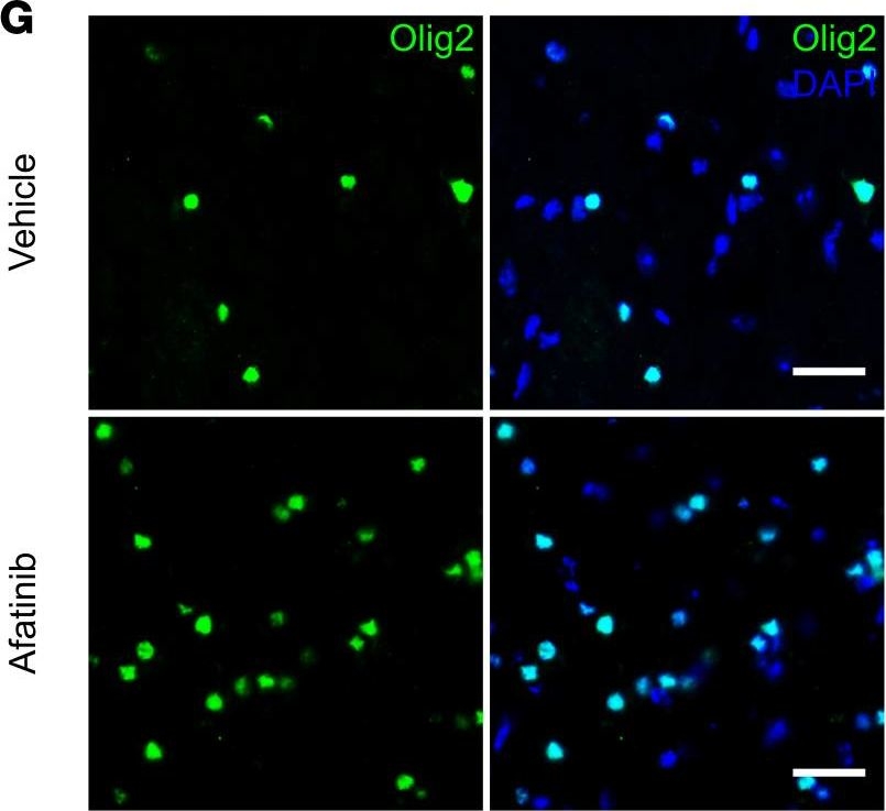 olig2 antibodies - Antibody search engine - CiteAb