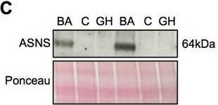 ASNS antibodies - Antibody search engine - CiteAb