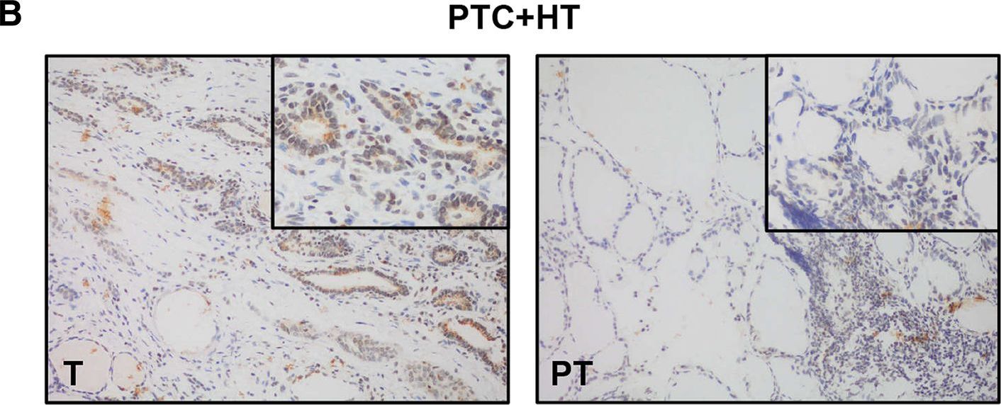 IL-17A antibodies - Antibody search engine - CiteAb