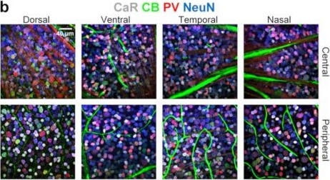 parvalbumin antibodies - Antibody search engine - CiteAb