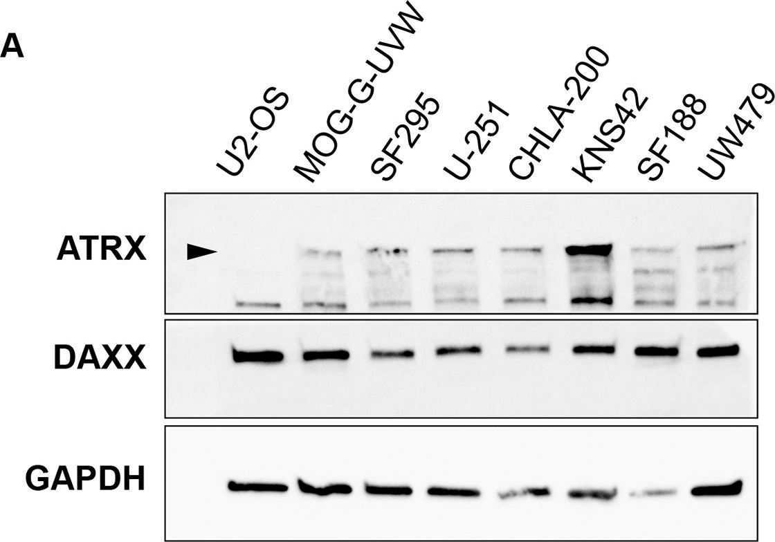 ATRX antibodies - Antibody search engine - CiteAb
