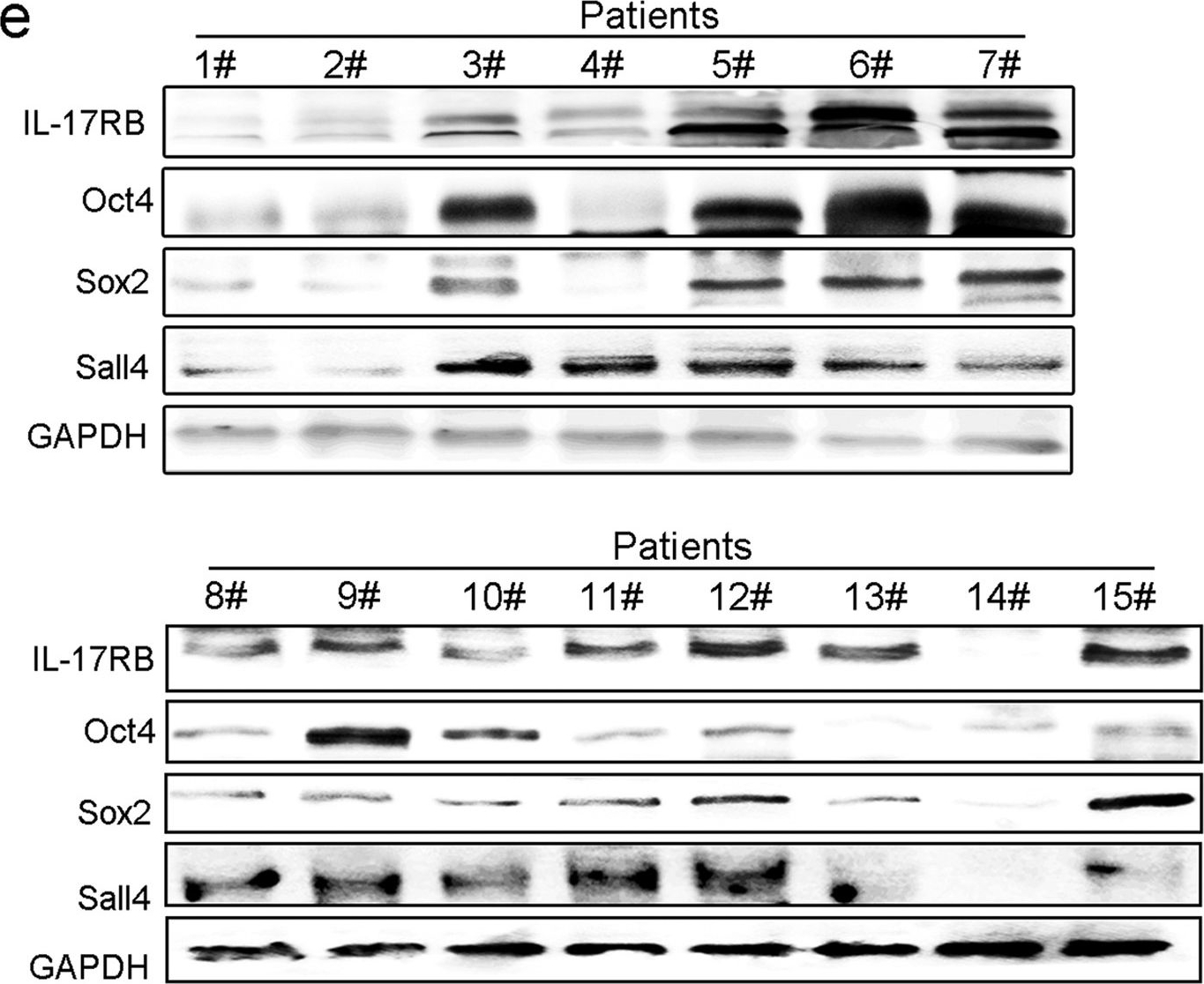 Sall4 antibodies - Antibody search engine - CiteAb