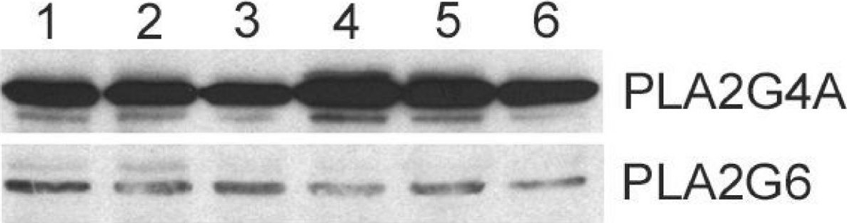 pla2g6 antibodies - Antibody search engine - CiteAb