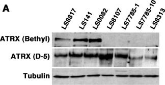ATRX antibodies - Antibody search engine - CiteAb
