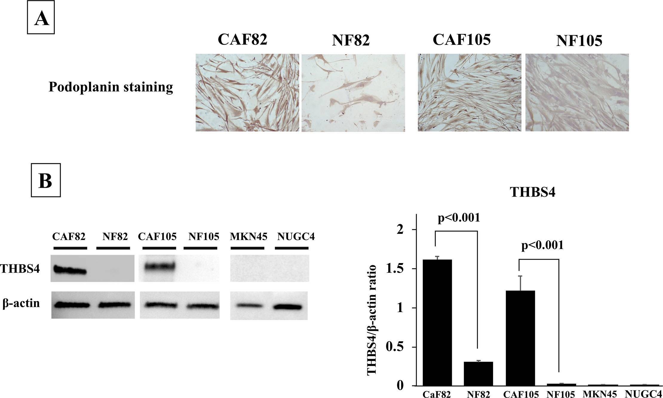thbs4 antibodies - Antibody search engine - CiteAb