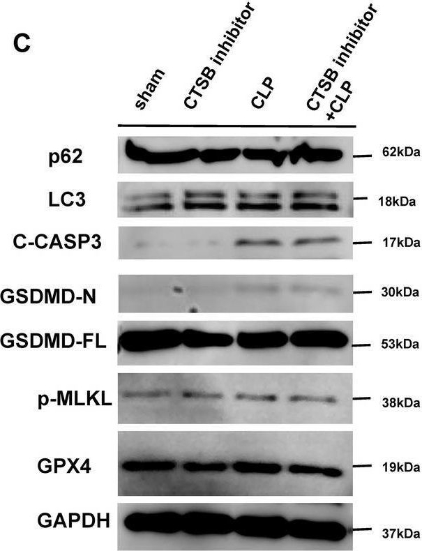LC3 antibodies - Antibody search engine - CiteAb