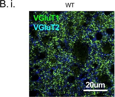 Vglut2 antibodies - Antibody search engine - CiteAb