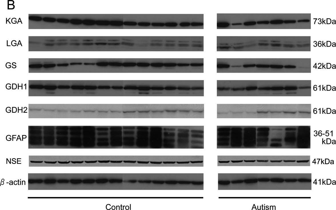 GLS1 antibodies - Antibody search engine - CiteAb