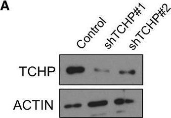TCHP antibodies - Antibody search engine - CiteAb