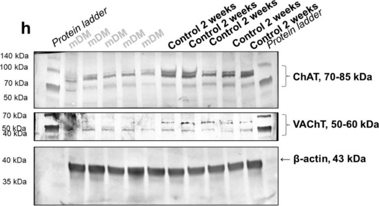 SLC18A3 antibodies - Antibody search engine - CiteAb