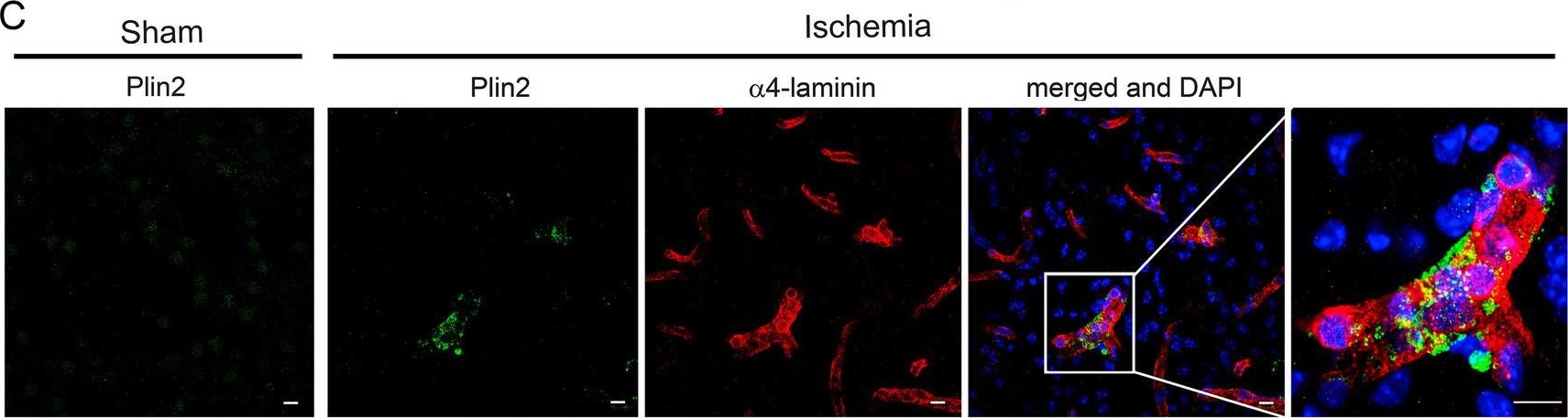 PLIN2 antibodies - Antibody search engine - CiteAb