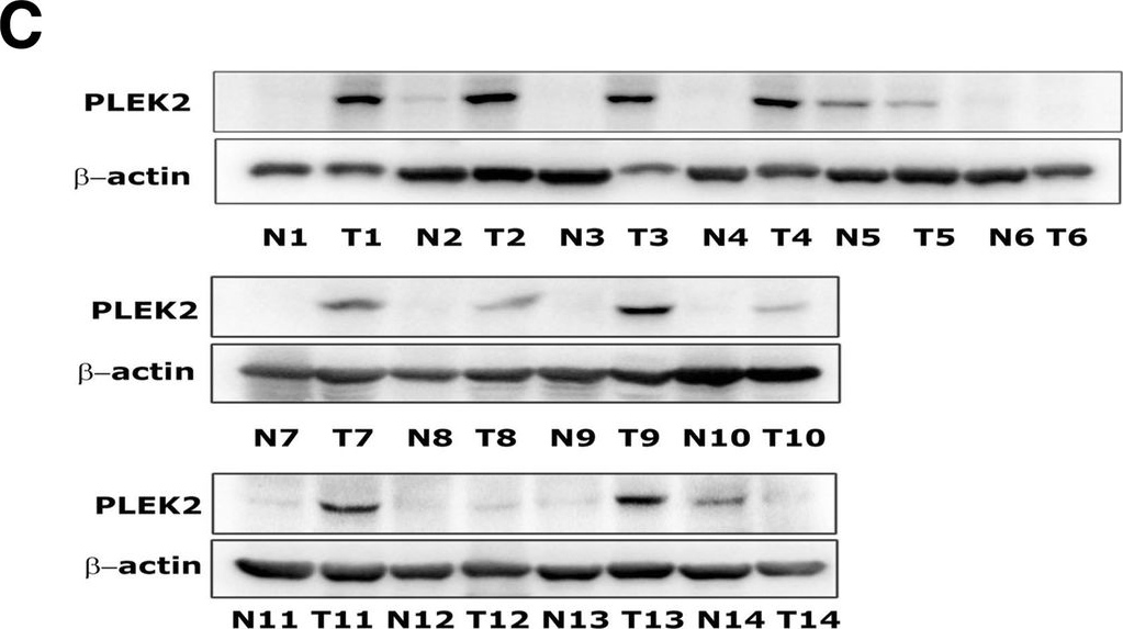 PLEK antibodies - Antibody search engine - CiteAb