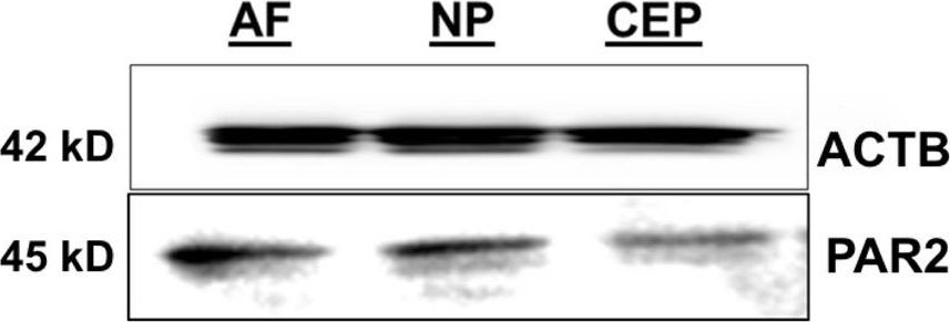F2RL1 antibodies - Antibody search engine - CiteAb