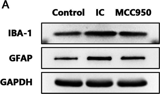iba-1 antibodies - Antibody search engine - CiteAb