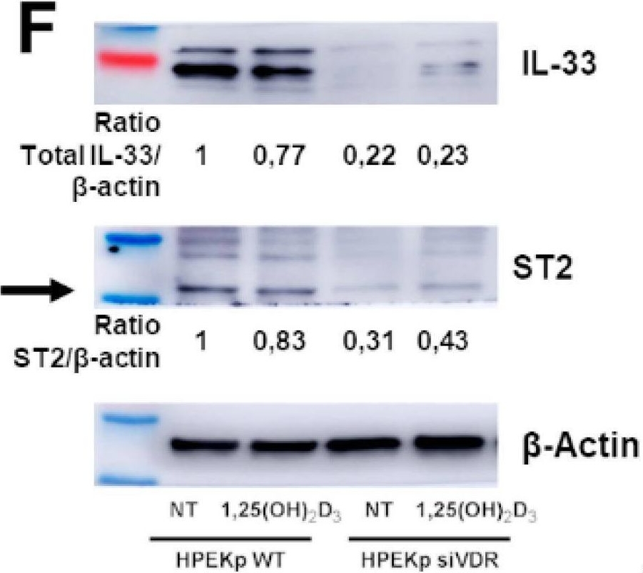 ST2 antibodies - Antibody search engine - CiteAb