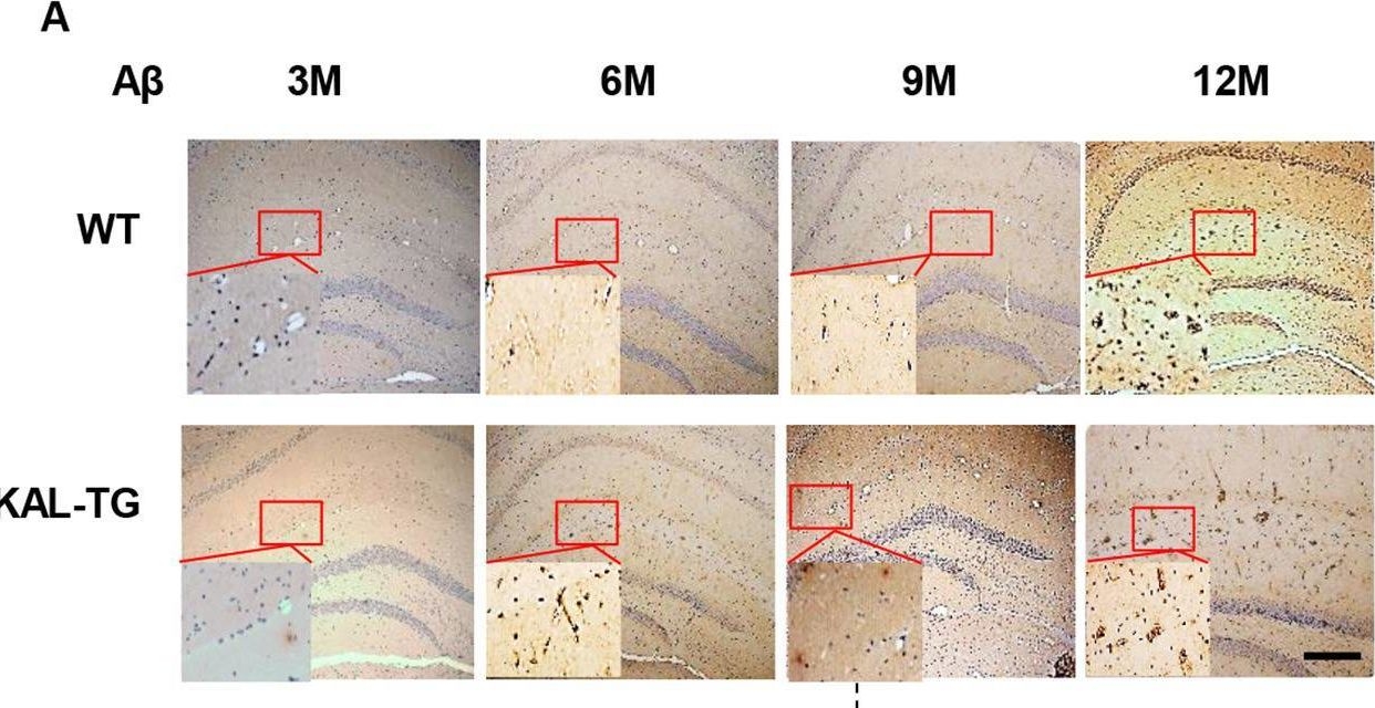 amyloid Protein antibodies - Antibody search engine - CiteAb