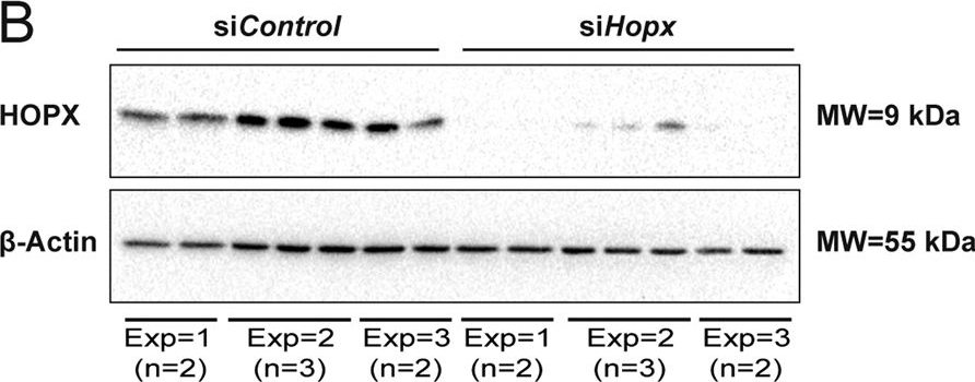 HOPX antibodies - Antibody search engine - CiteAb