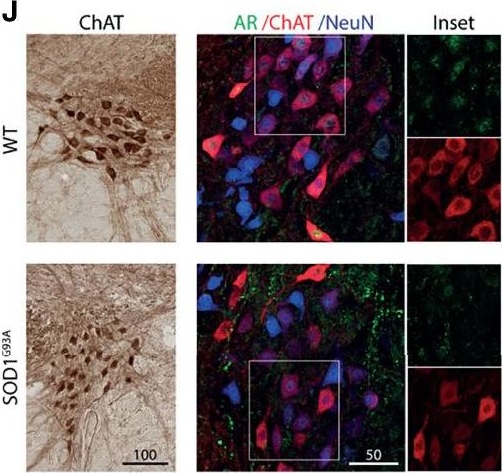 CHAT antibodies - Antibody search engine - CiteAb