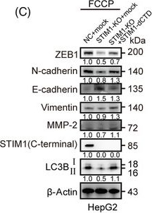 mmp2 antibodies - Antibody search engine - CiteAb