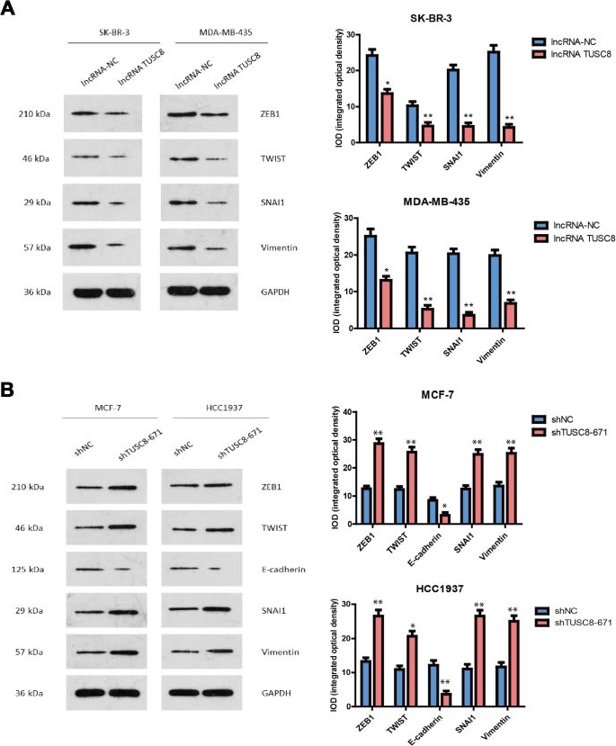 Zeb1 antibodies - Antibody search engine - CiteAb