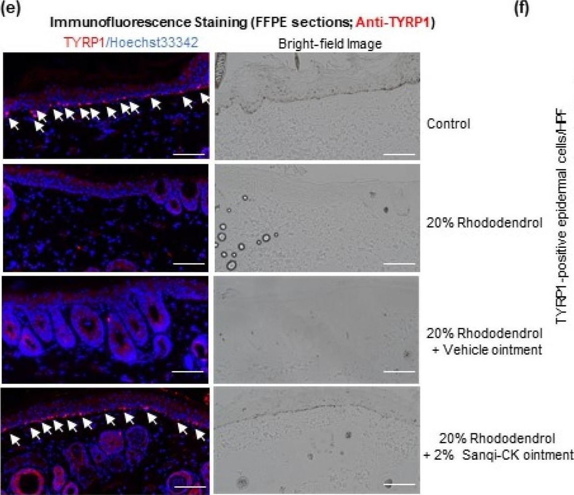 TYRP1 antibodies - Antibody search engine - CiteAb