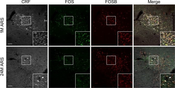 FOS antibodies - Antibody search engine - CiteAb