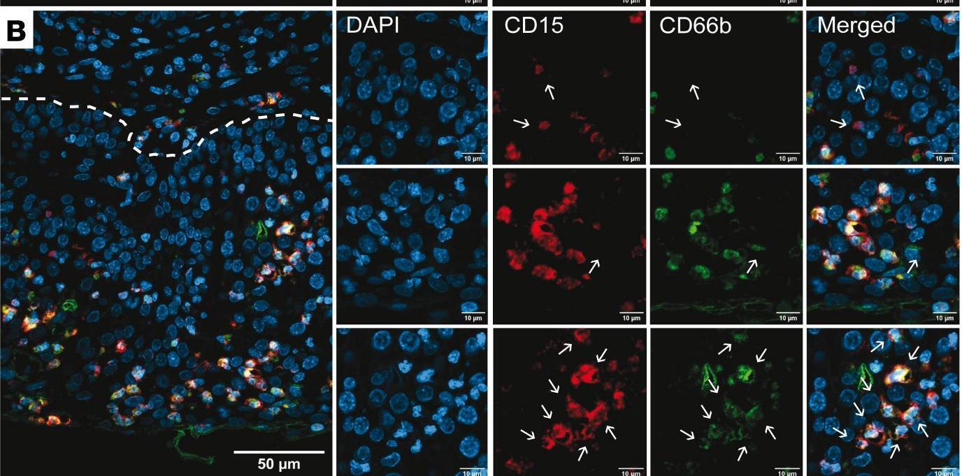 CD66b antibodies - Antibody search engine - CiteAb