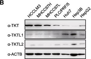 TKTL1 antibodies - Antibody search engine - CiteAb