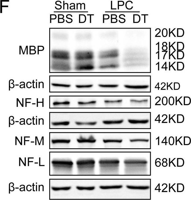 NF200 antibodies - Antibody search engine - CiteAb