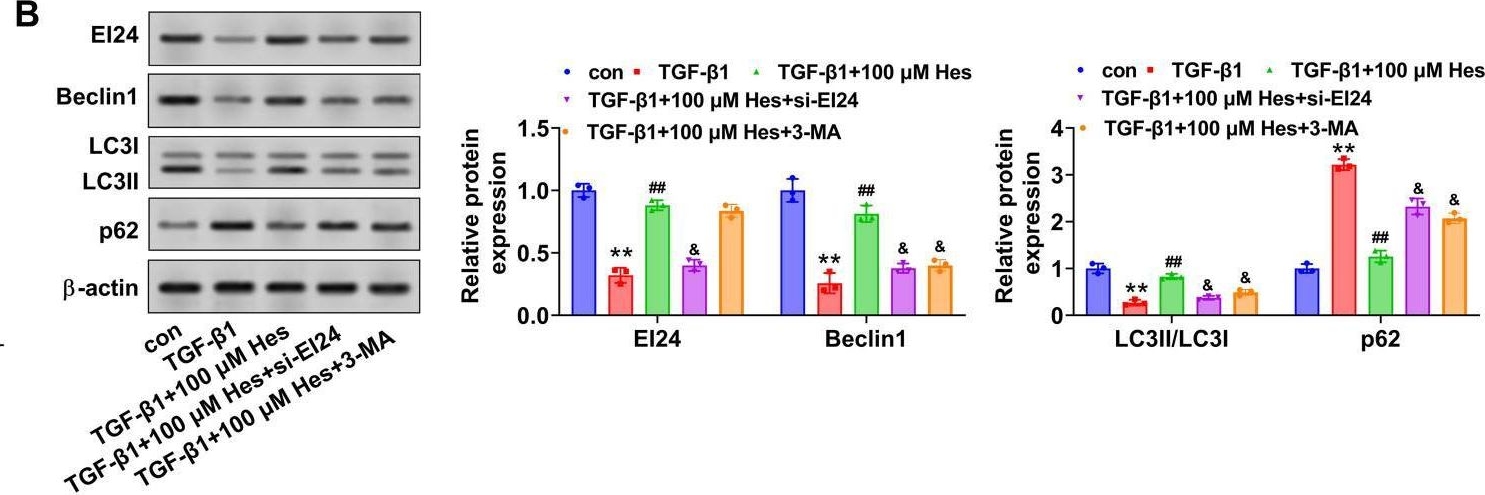 LC3 antibodies - Antibody search engine - CiteAb