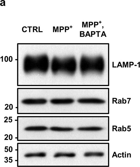 RAB7 antibodies - Antibody search engine - CiteAb