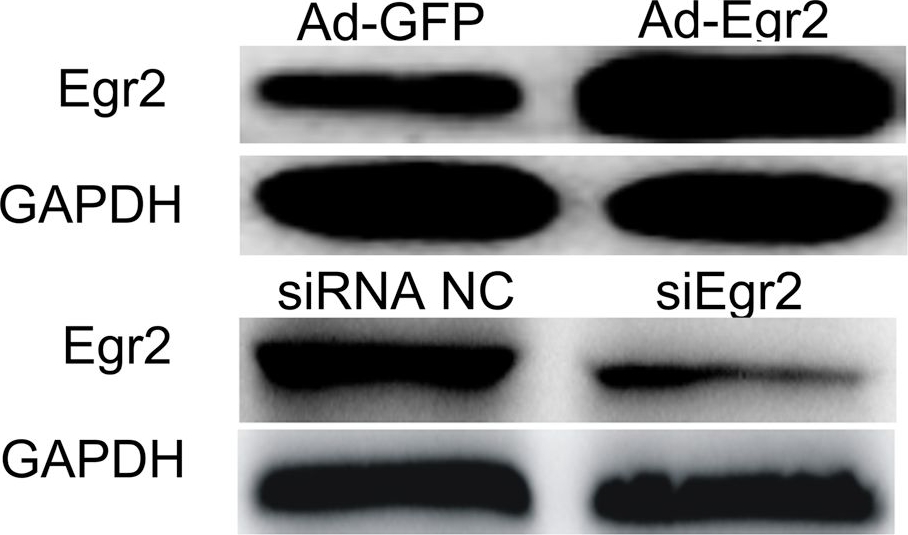 Egr2 antibodies - Antibody search engine - CiteAb