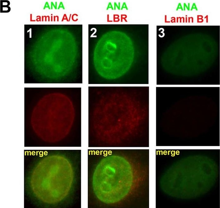 LMNA antibodies - Antibody search engine - CiteAb